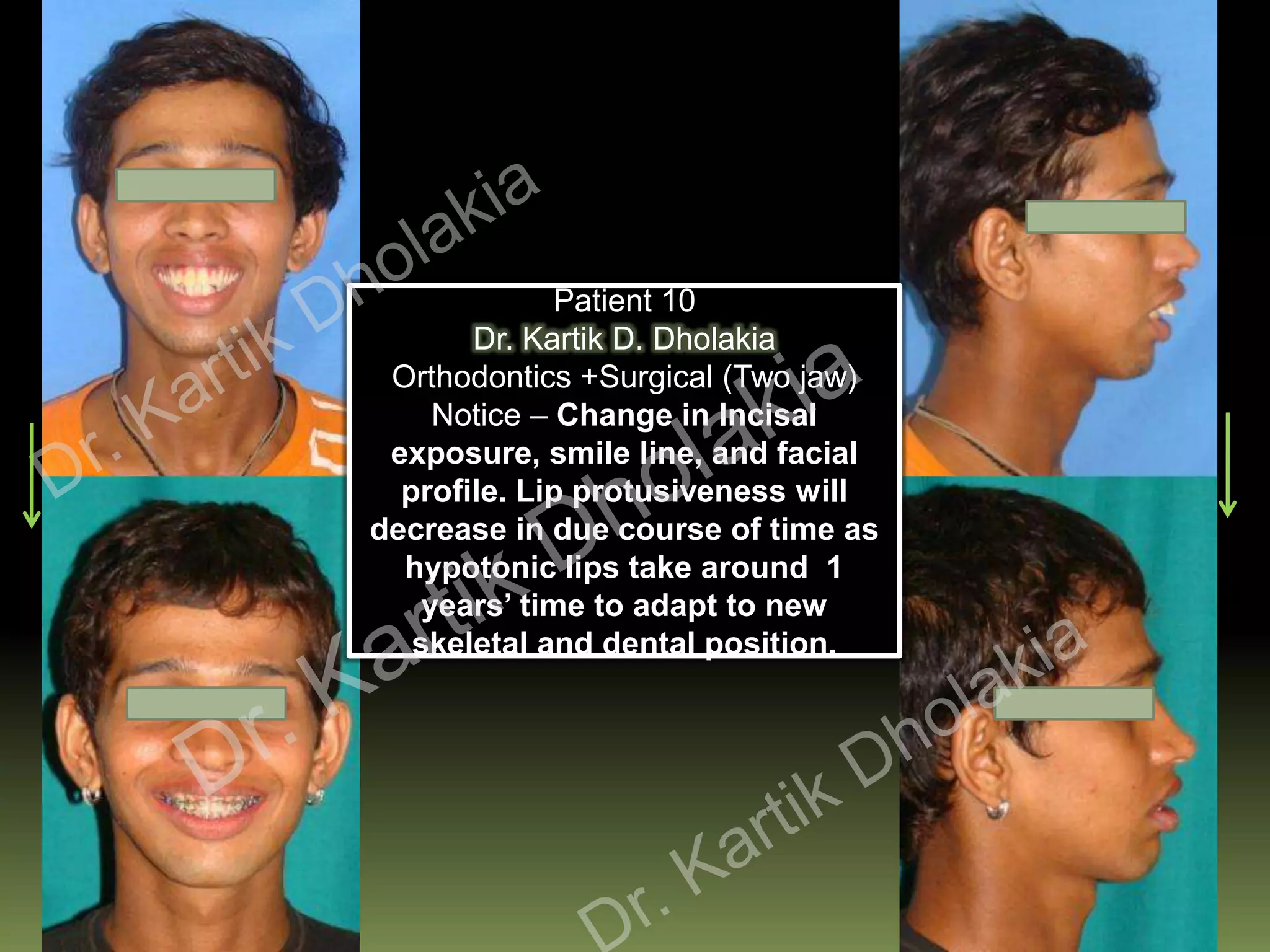 Cases - KD Orthodontics | PPSX