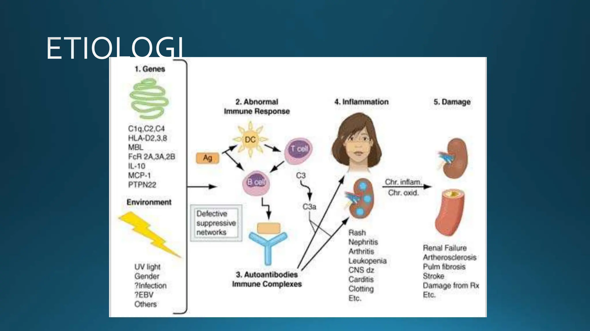 CASE REPORT Lupus Eritematosus Sistemik (Systemic lupus erythematosus/SLE) ppt.pptx