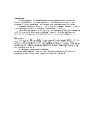 Case report :systemic torulopsis after gastric bypass operation | DOC