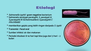 Case Report Typhoid Fever | PPTX