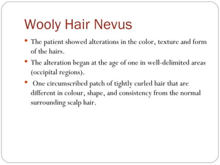 wooly hair and nevoid hipermelanosis | PPT