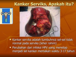 kp Ca serviks | PPT