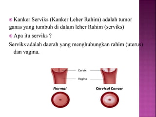 kanker serviks adalah penyakit kanker mulut rahim yang sangat berbahaya ...