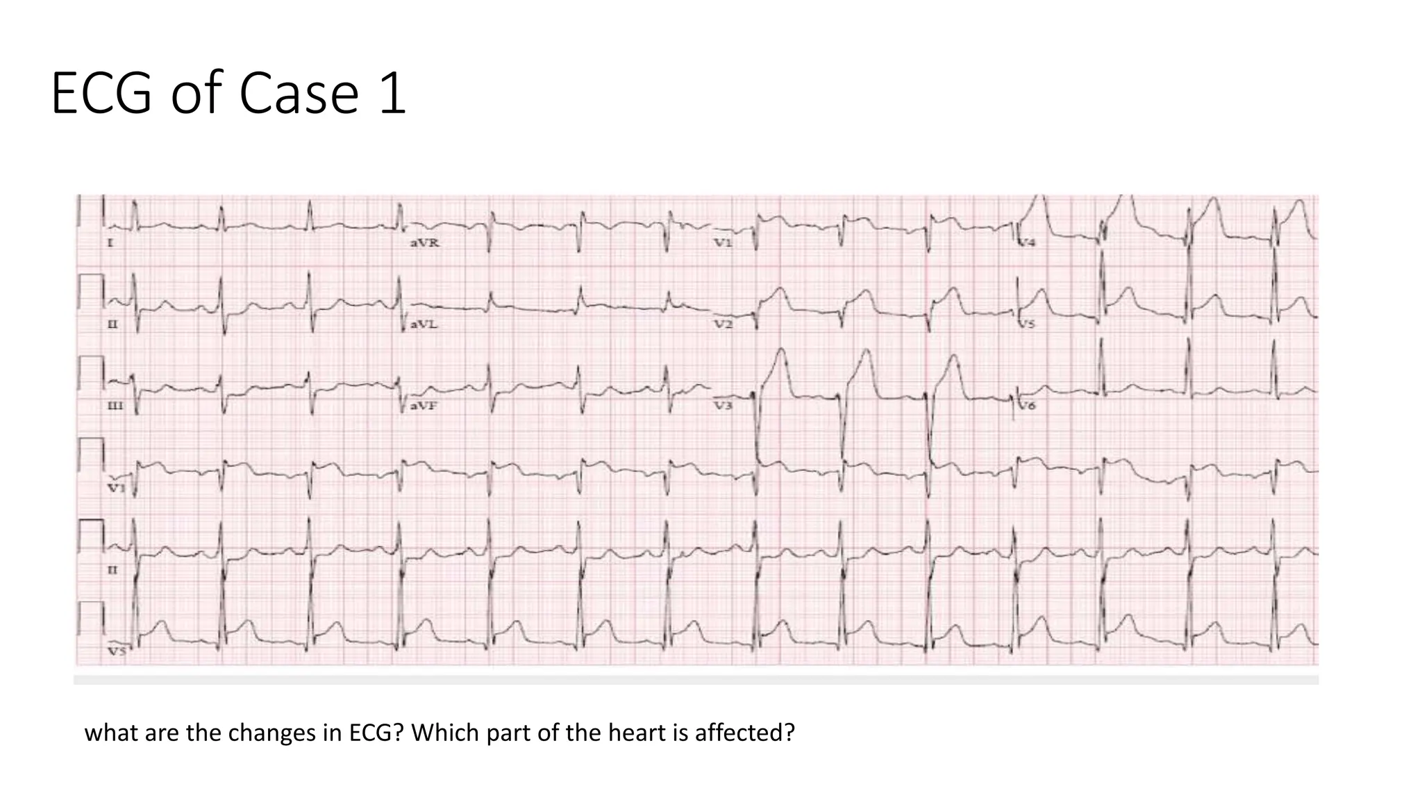 Case scenario of ECE.pptx AIIMS Bilaspur first year | PPTX