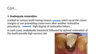 case selection and endodontic treatment.pptx