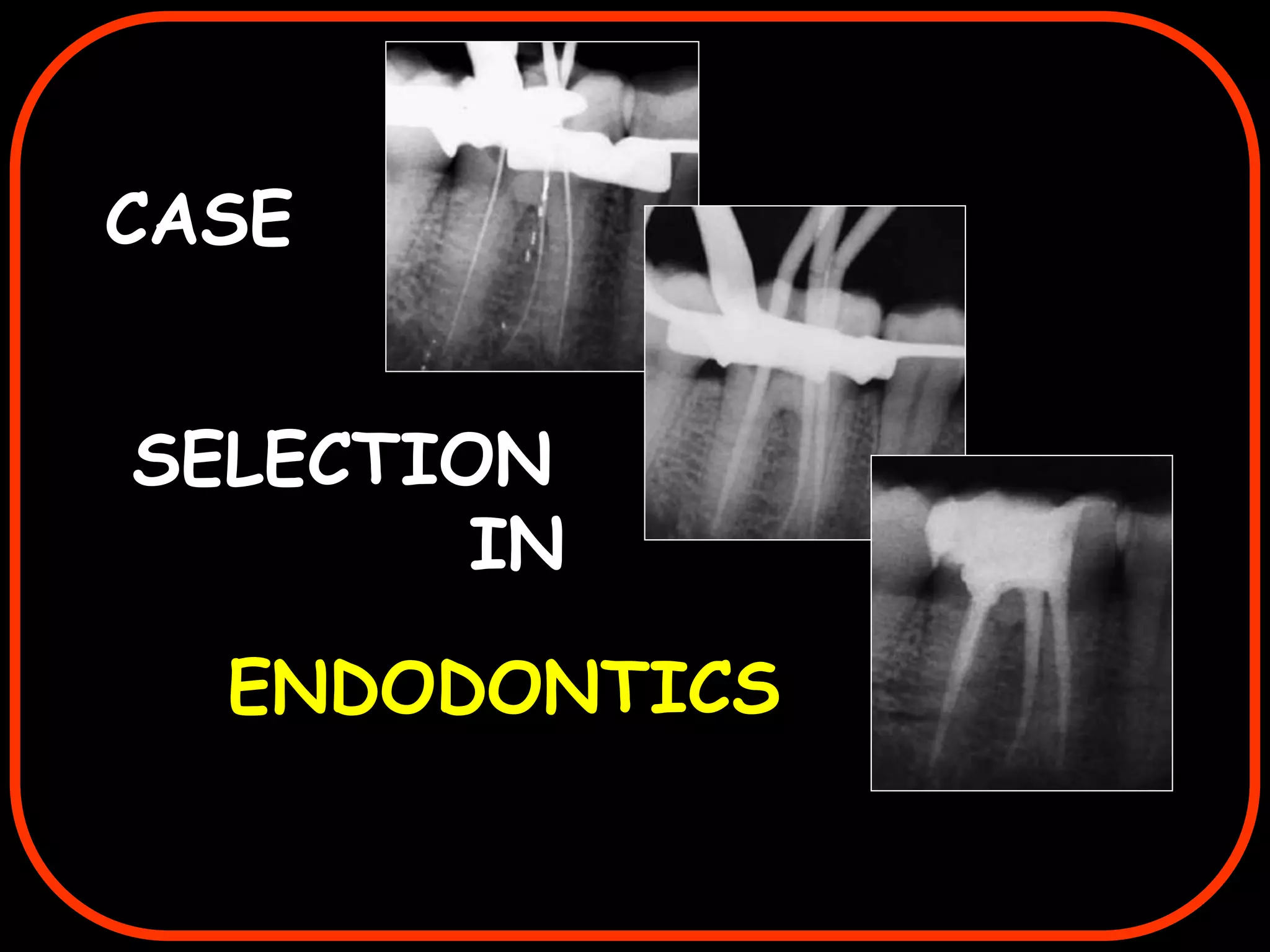 Case selection in endodontics | PPTX