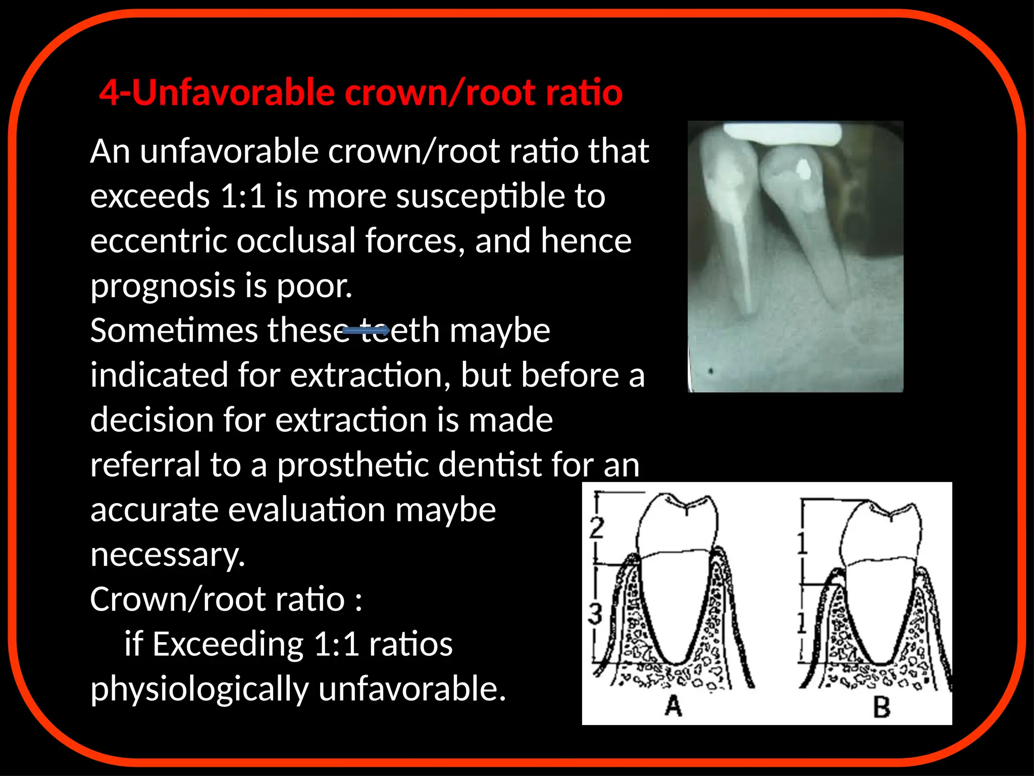 Endodontic diagnosis _case selection in endodontics (1).pptx