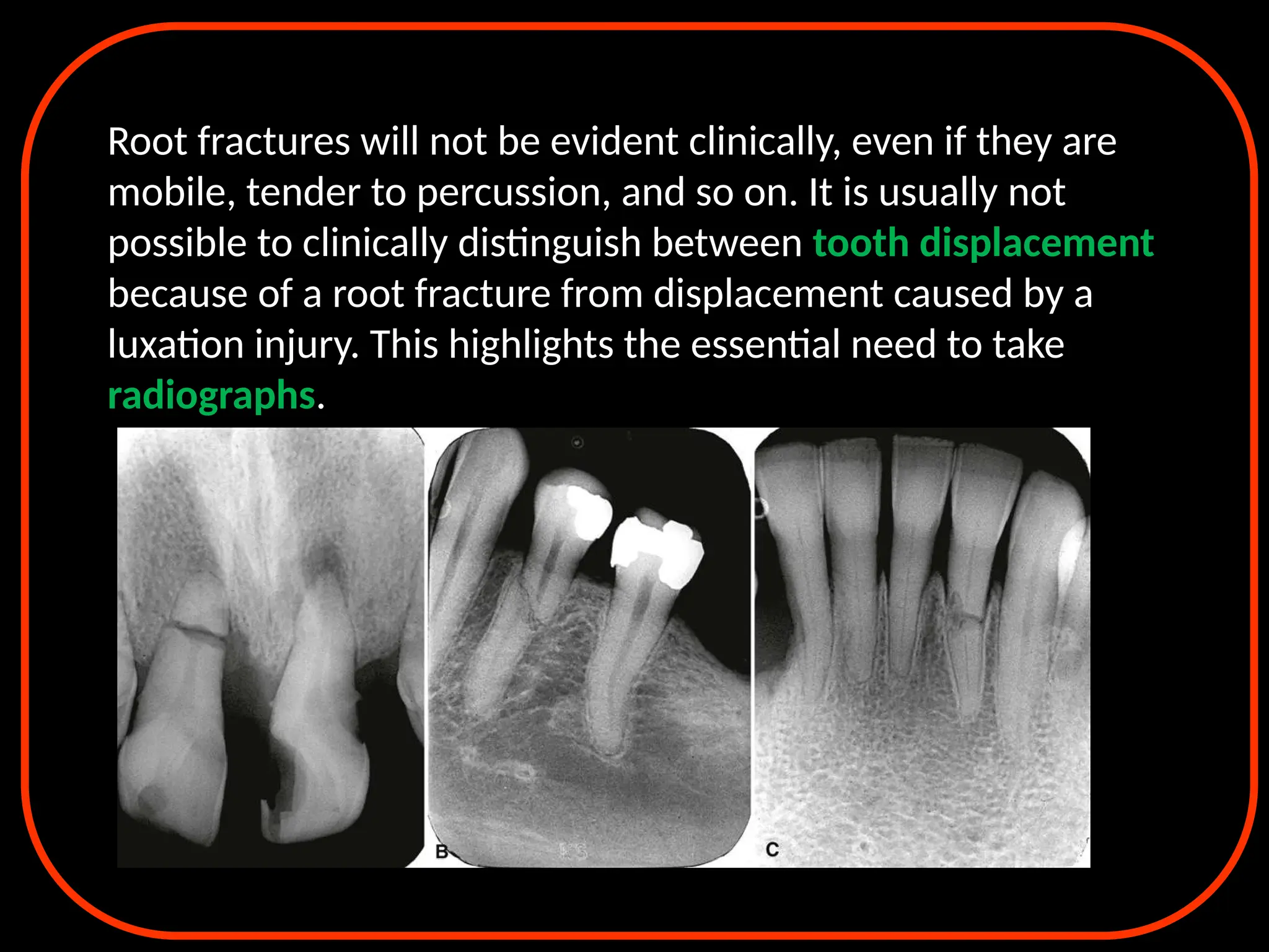 Endodontic diagnosis _case selection in endodontics (1).pptx