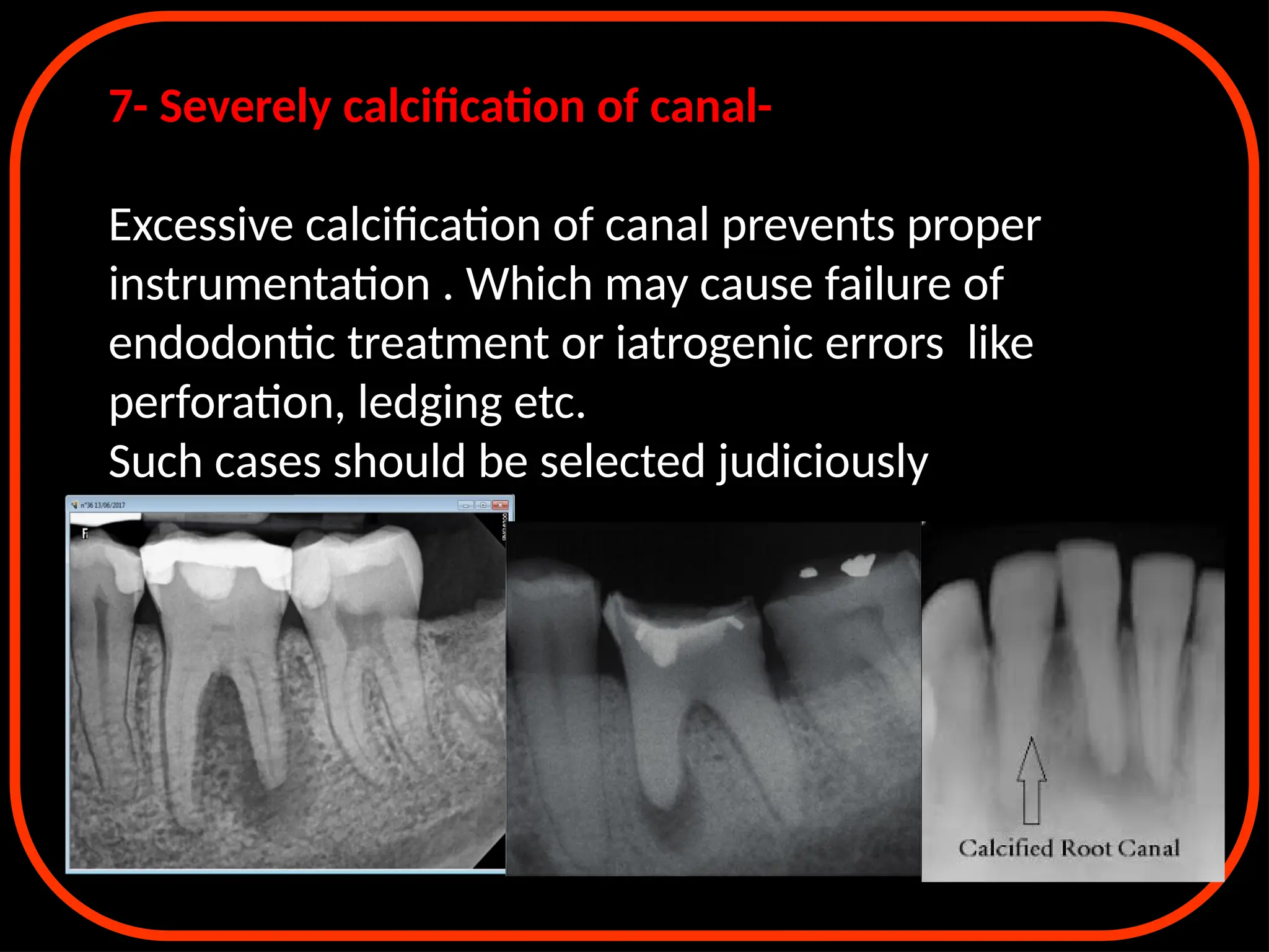 Endodontic diagnosis _case selection in endodontics (1).pptx