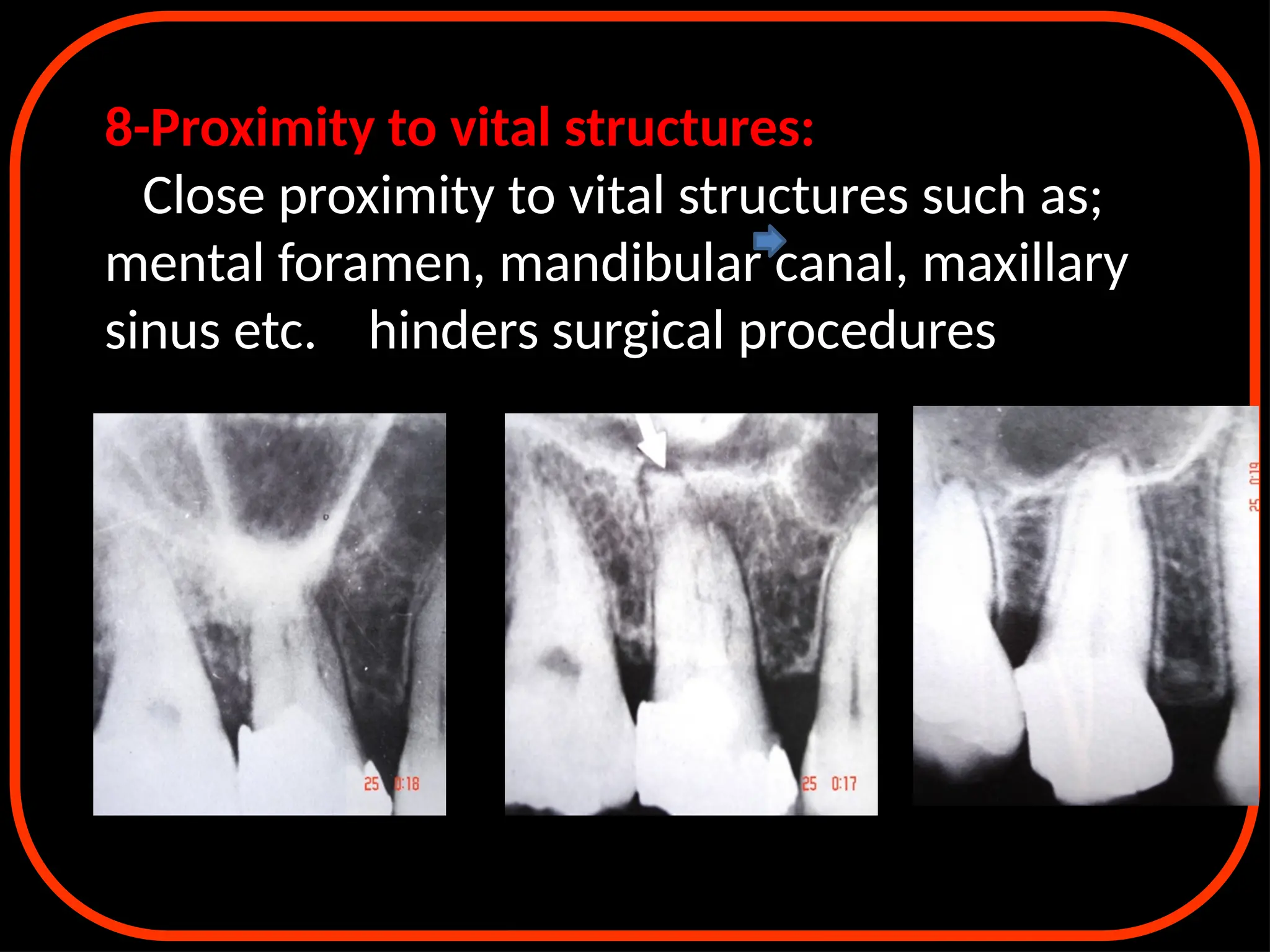 Endodontic diagnosis _case selection in endodontics (1).pptx