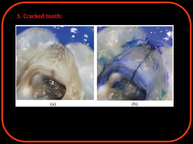 Endodontic diagnosis _case selection in endodontics (1).pptx