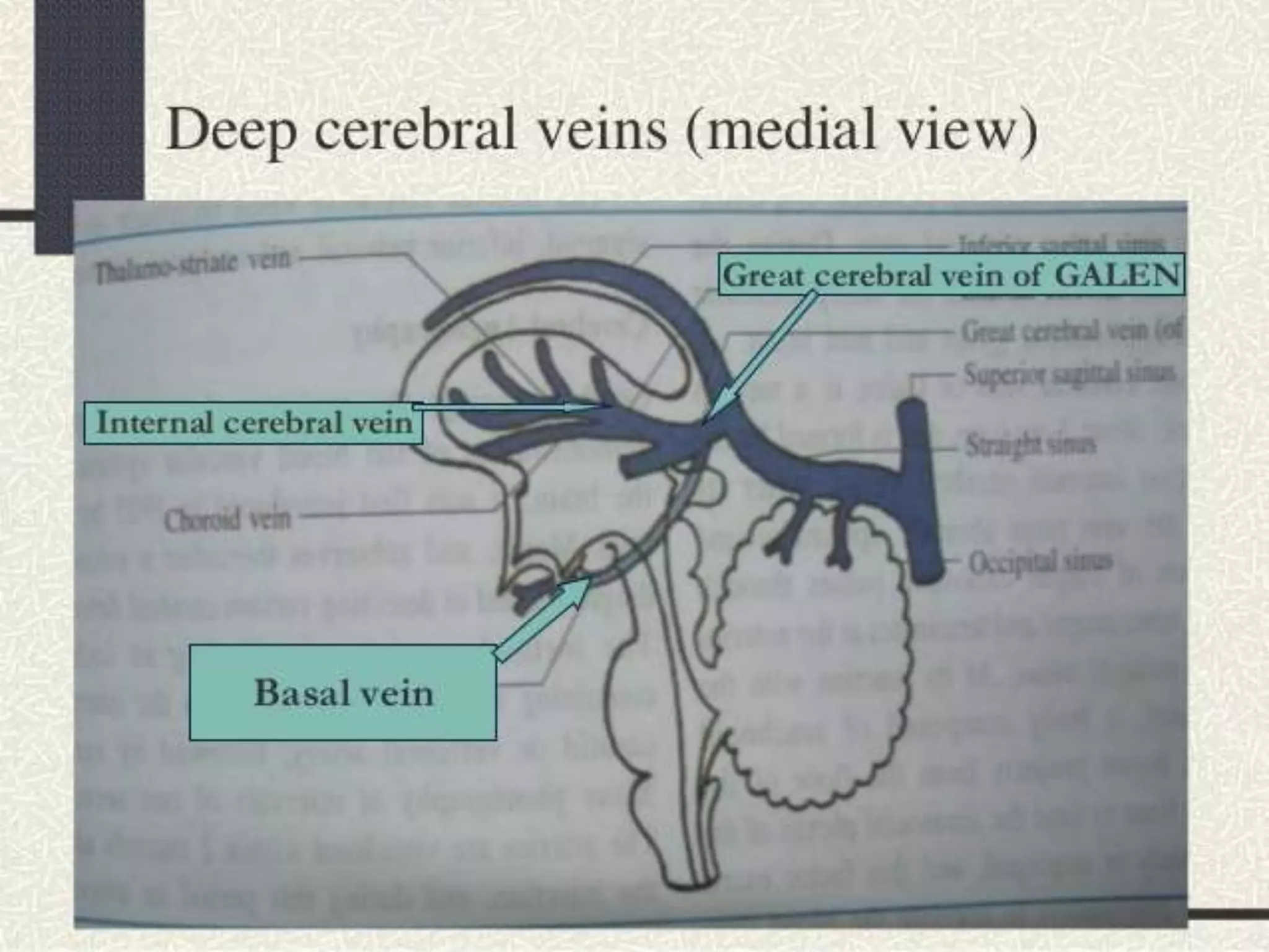 Case series -cerebral venous sinus thrombosis - Dr Shaz Pamangadan | PPTX