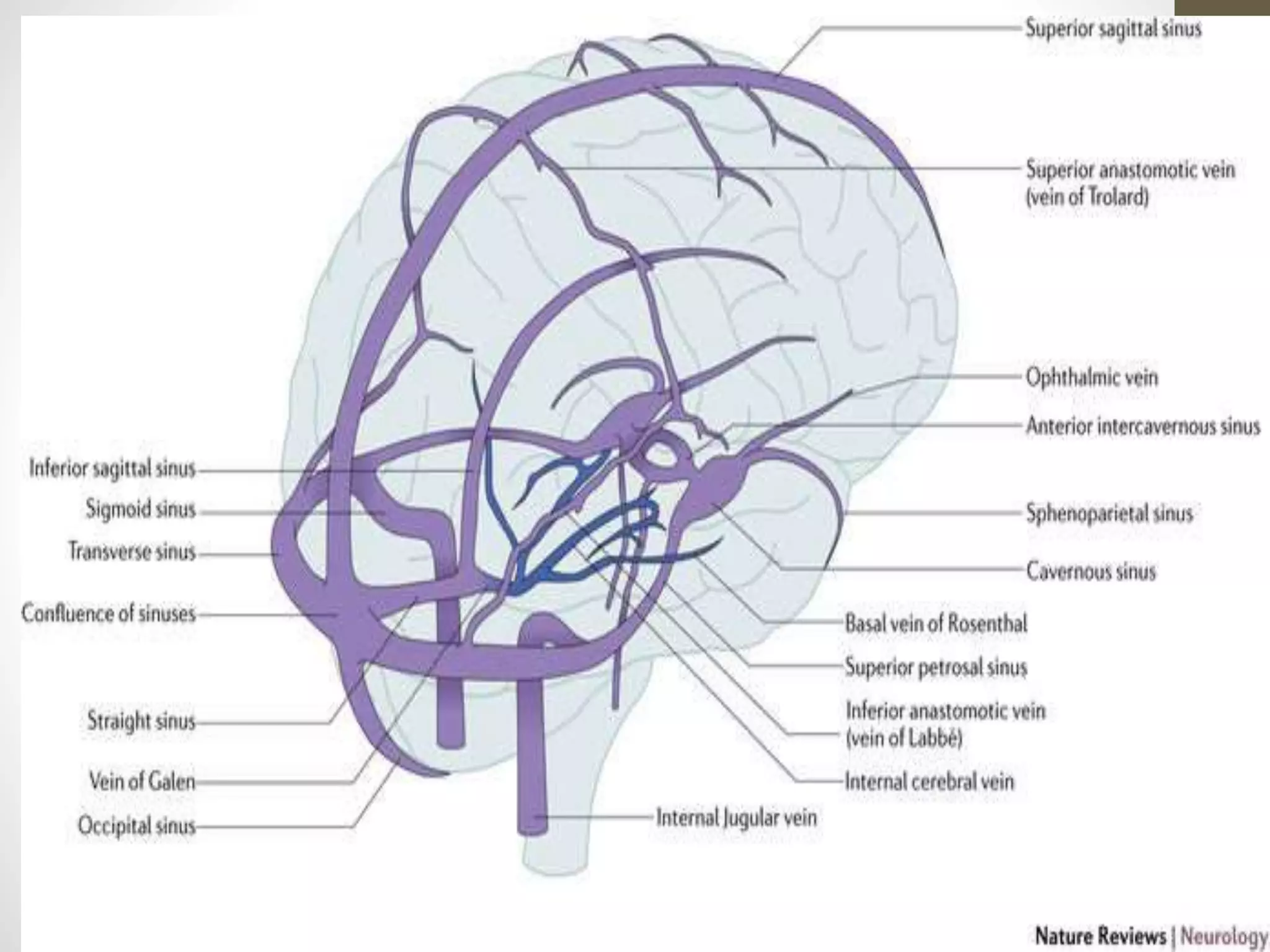 Case series -cerebral venous sinus thrombosis - Dr Shaz Pamangadan | PPTX