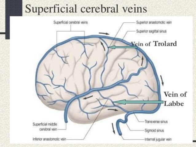 Case series -cerebral venous sinus thrombosis - Dr Shaz Pamangadan | PPT
