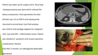 Case series of pseudocyst of pancreas | PPT