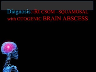 Case series otogenic brain abcess | PPT