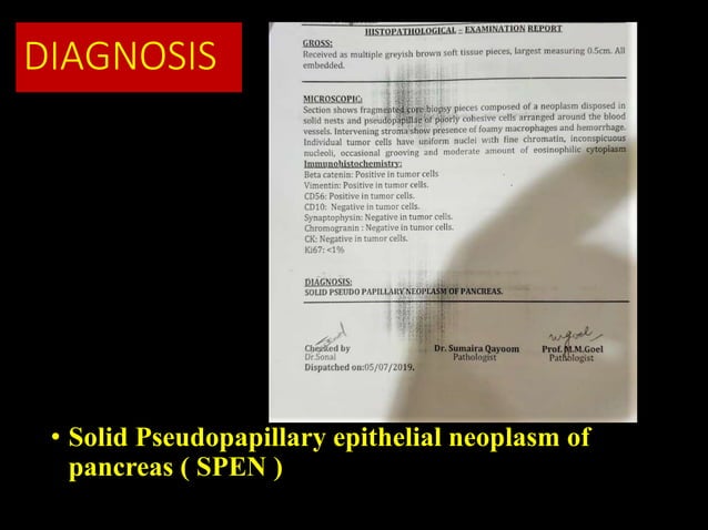 Spen Pancrease Case Pptx 4114