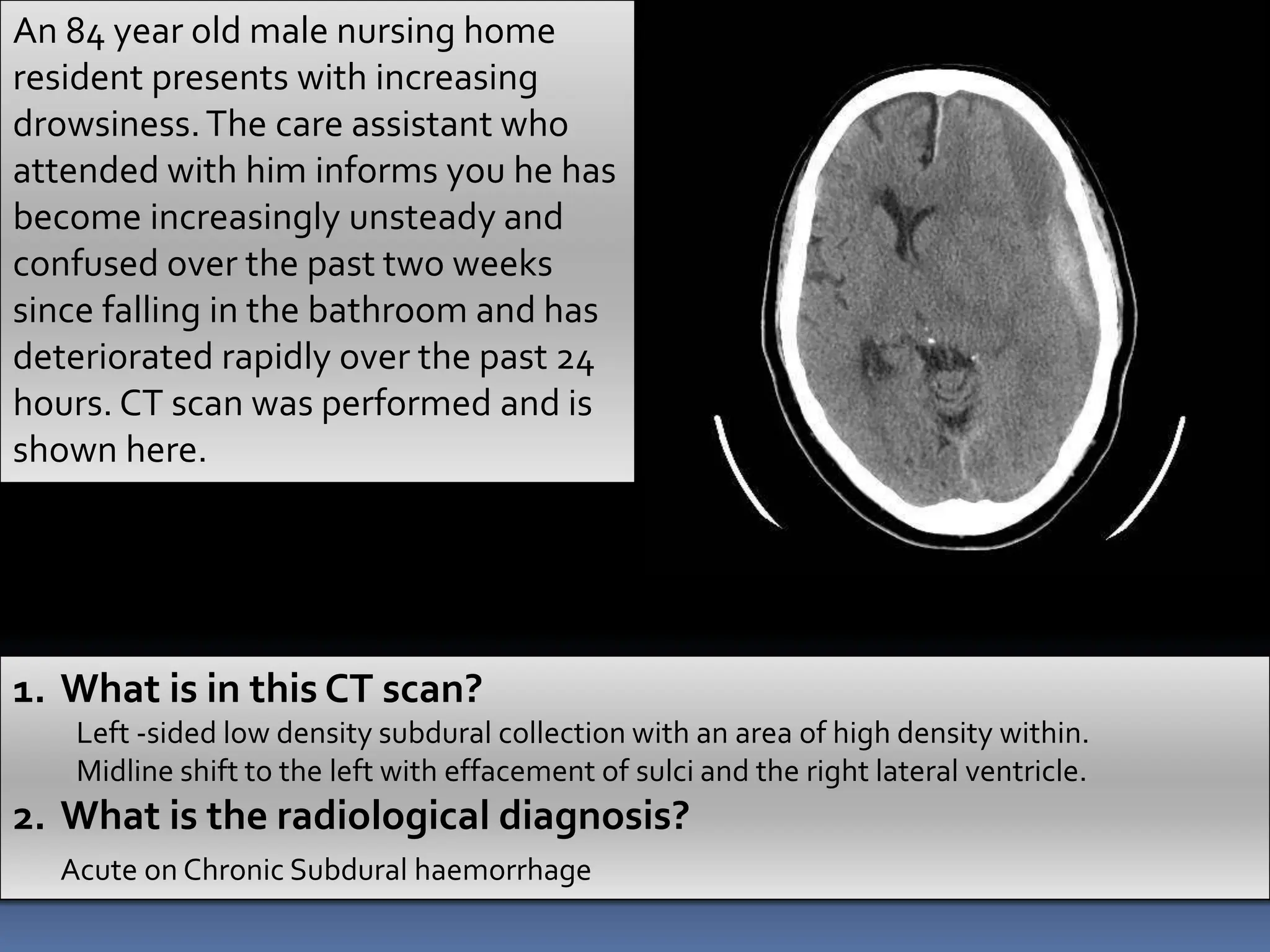 Case Studies - Brain CT scan explained.pptx