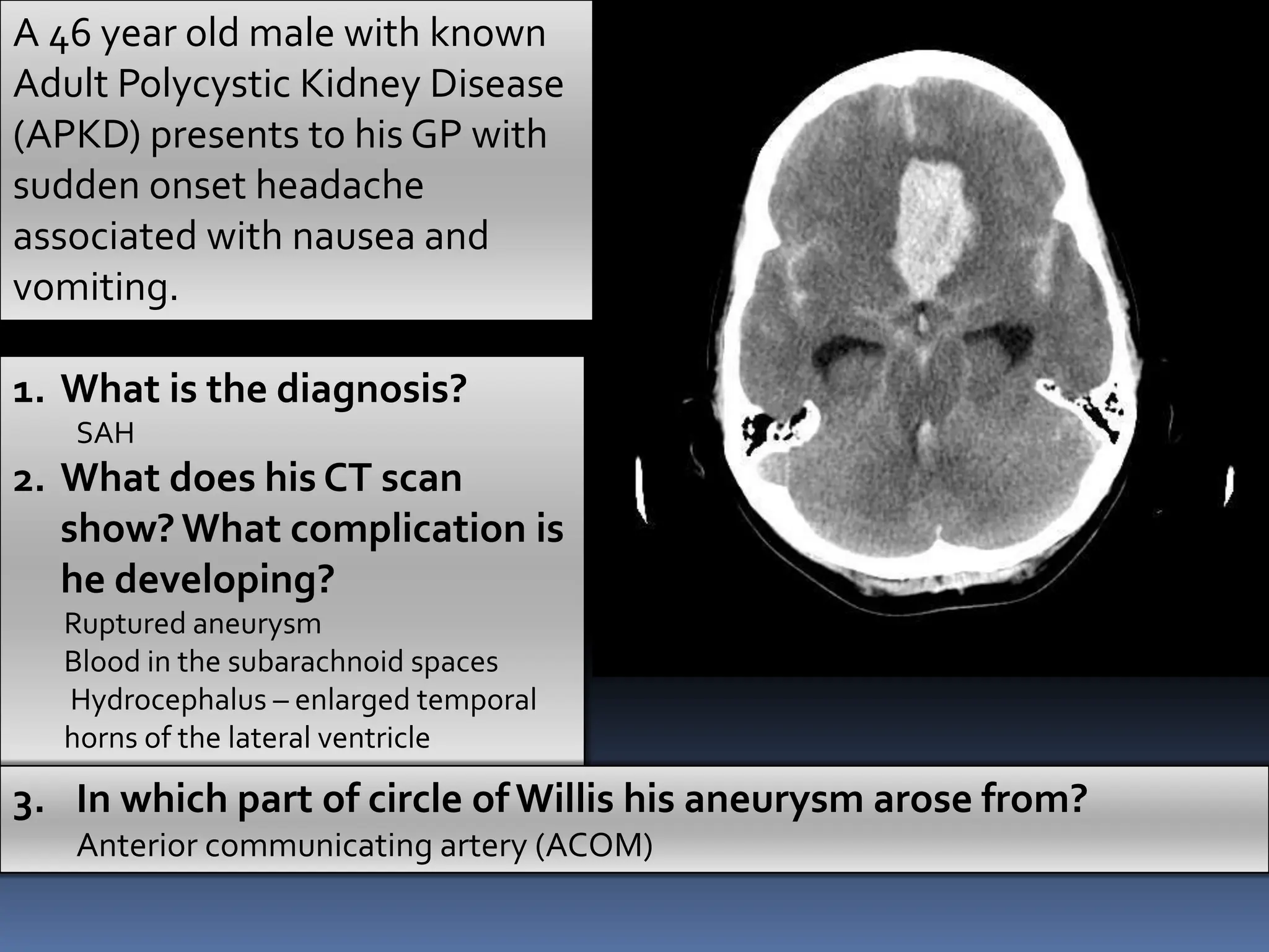 Case Studies - Brain CT scan explained.pptx