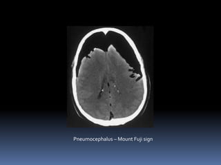 Case Studies - Brain CT scan explained.pptx