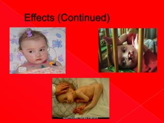 Chernobyl Disaster Human Effects