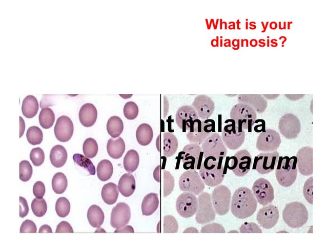 Parasitological case study | PPT