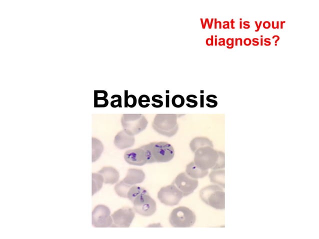 Parasitological case study | PPT