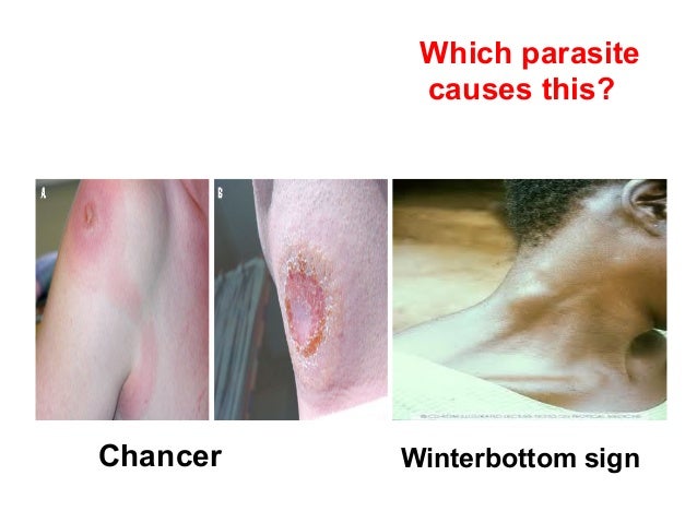Parasitological case study