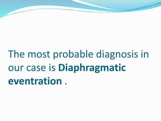 Case Study: Diaphragm Eventration with differtials | PPTX