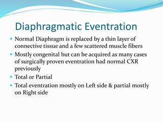 Case Study: Diaphragm Eventration with differtials | PPT