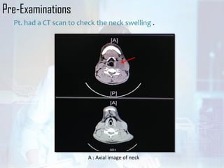 Octreotide Case study | PDF