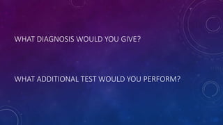 Case study: Gilbert Syndrome | PPTX
