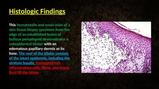 Case Study of syphilis in patient comes to | PPTX