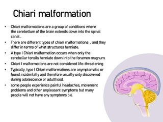 Osteopetrosis and Chiari type I malformation (a rare association( | PDF