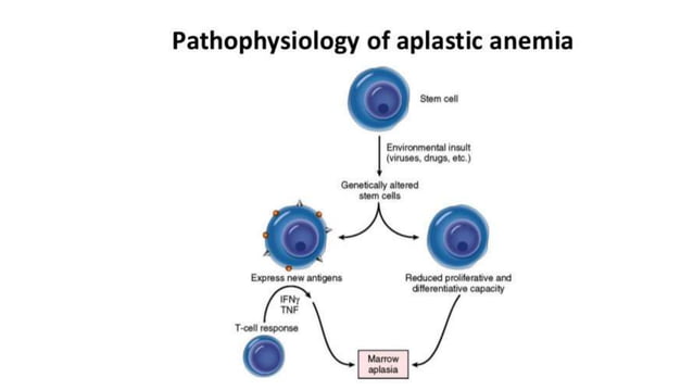 Case Study - Aplastic Anemia