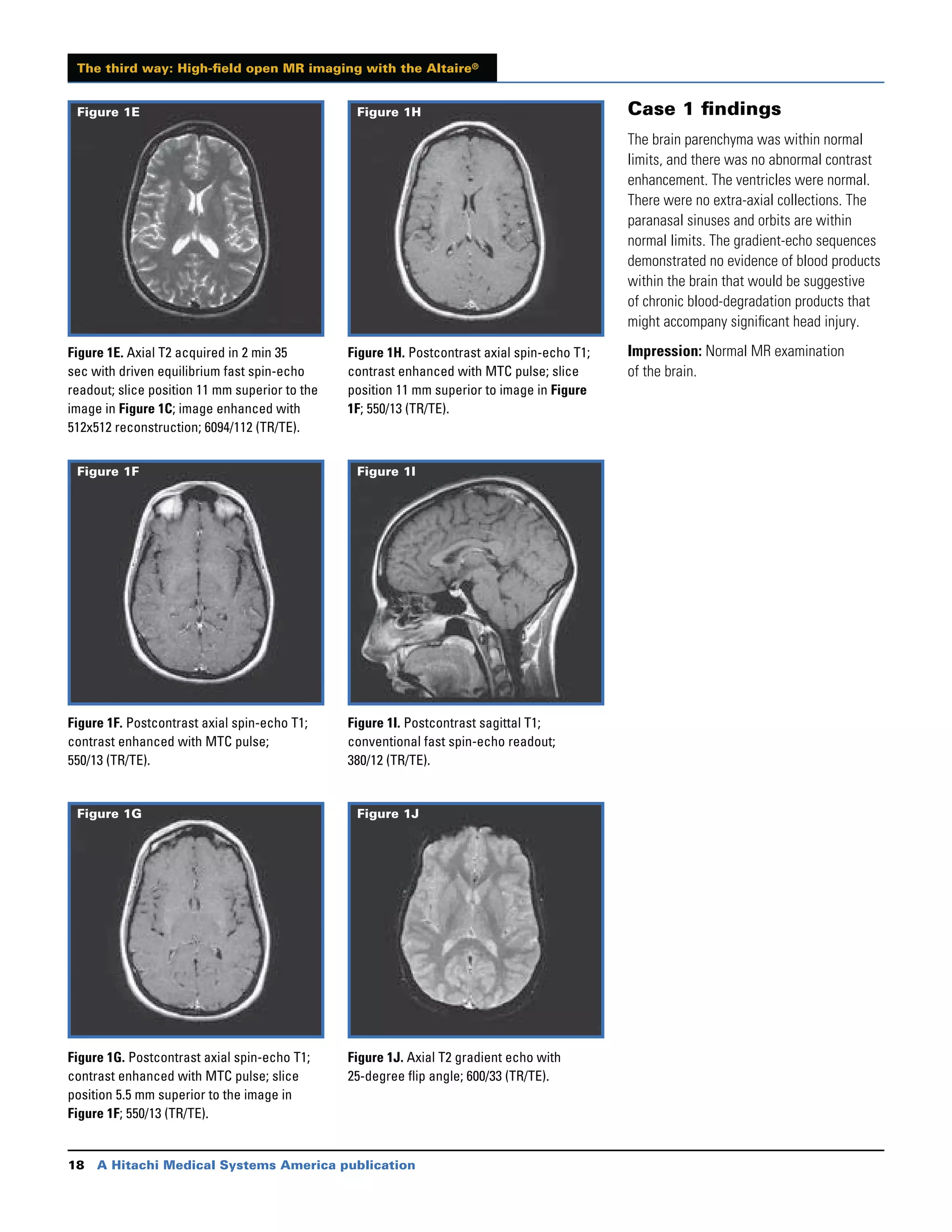 Case Study: Diagnostic Neuroradiology with the Altaire High Field OPEN ...