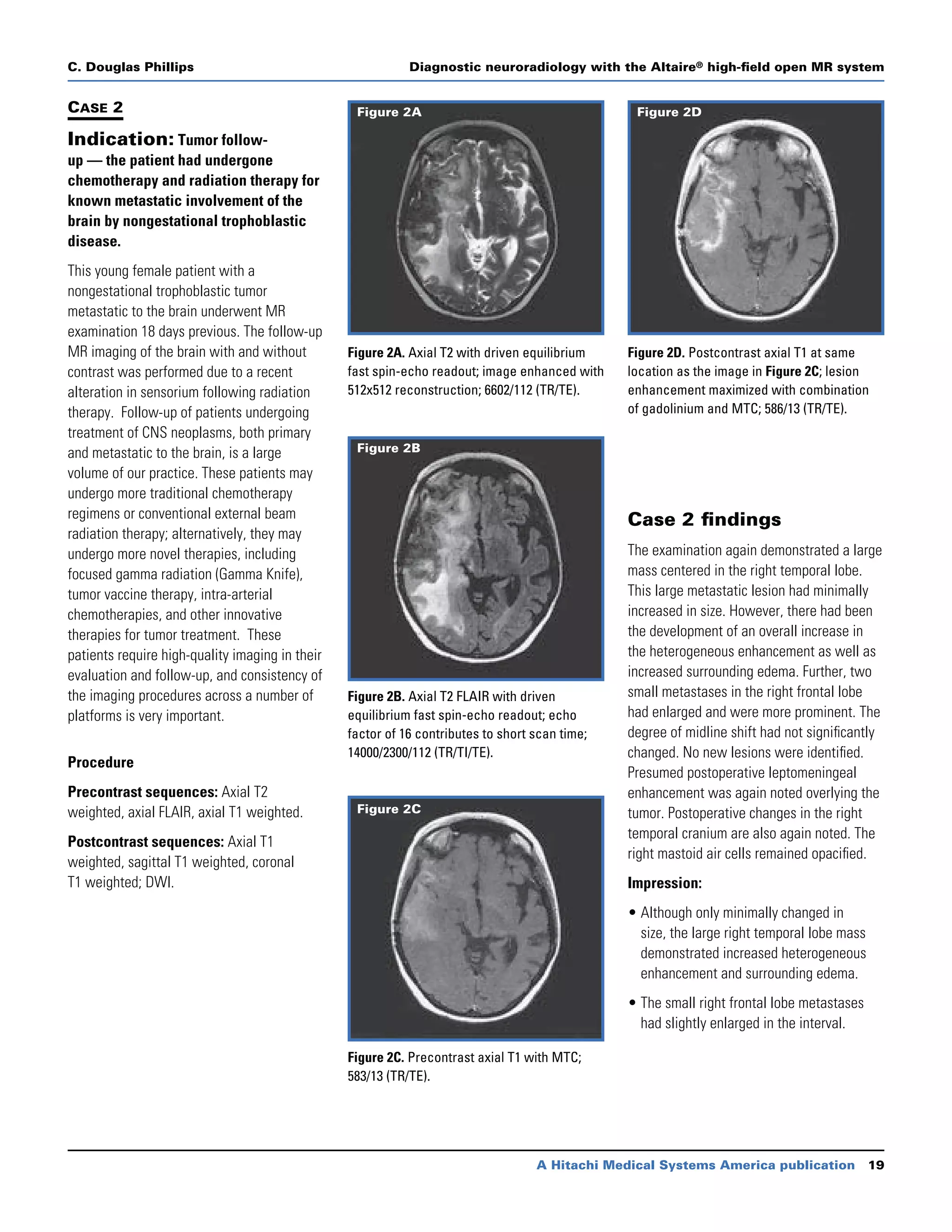 Case Study: Diagnostic Neuroradiology with the Altaire High Field OPEN ...