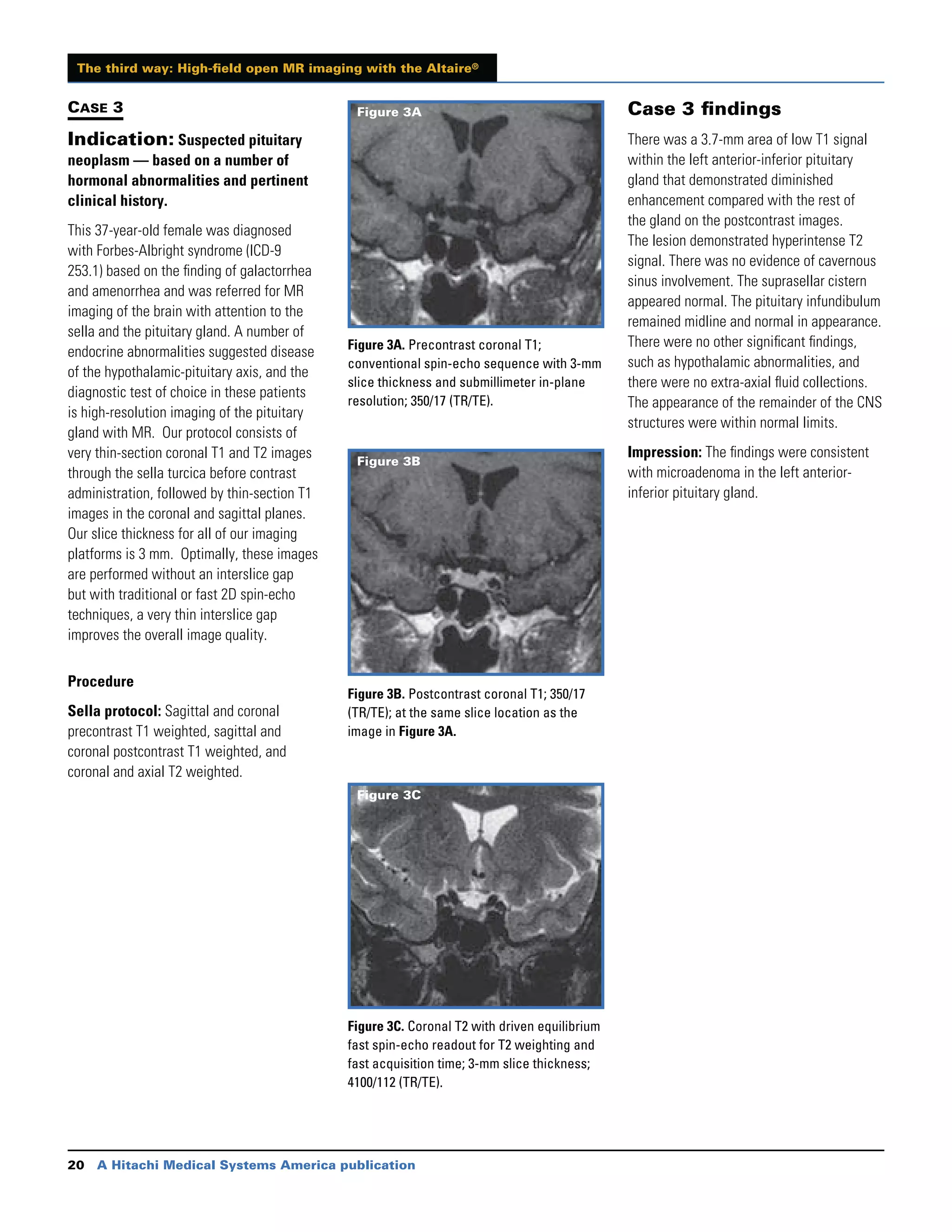 Case Study: Diagnostic Neuroradiology with the Altaire High Field OPEN ...
