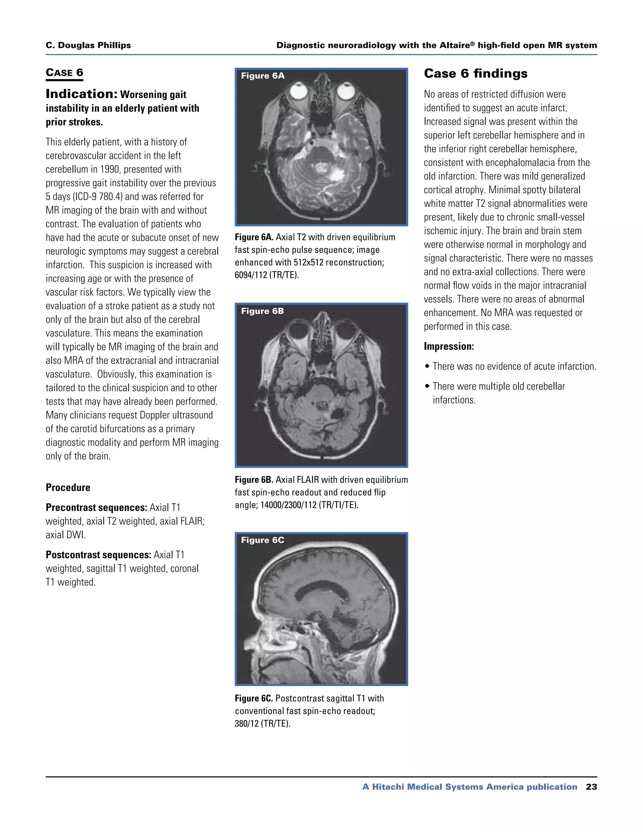 Case Study: Diagnostic Neuroradiology with the Altaire High Field OPEN ...