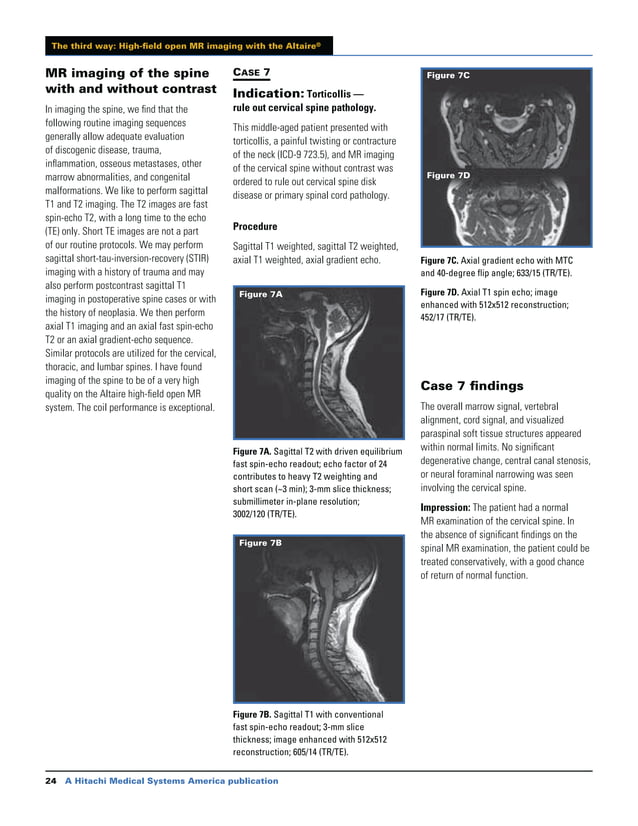 Case Study: Diagnostic Neuroradiology with the Altaire High Field OPEN MRI | PDF