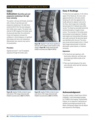 Case Study: Diagnostic Neuroradiology with the Altaire High Field OPEN ...