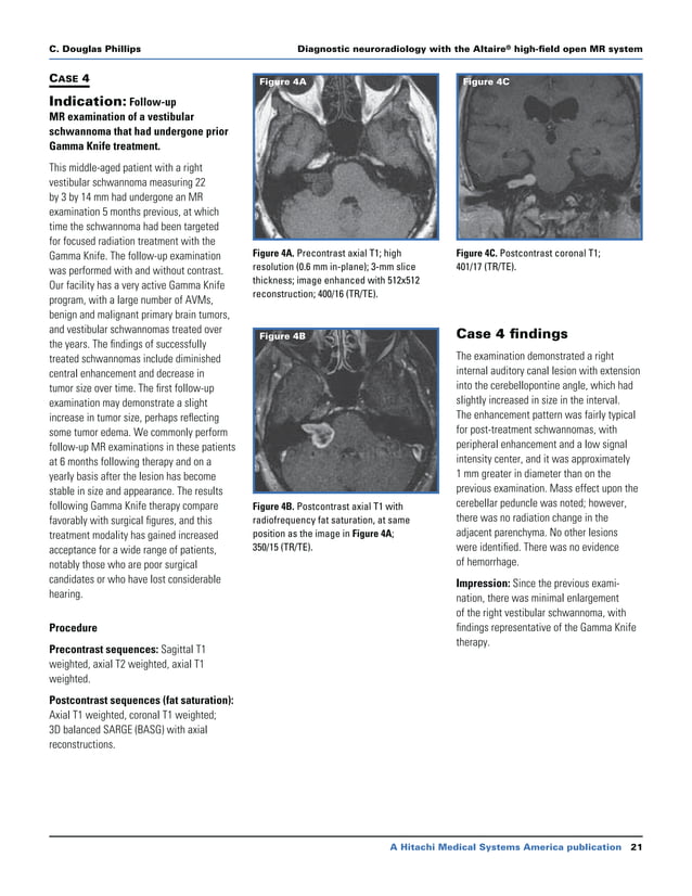 Case Study: Diagnostic Neuroradiology with the Altaire High Field OPEN ...