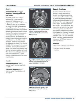 Case Study: Diagnostic Neuroradiology with the Altaire High Field OPEN MRI | PDF