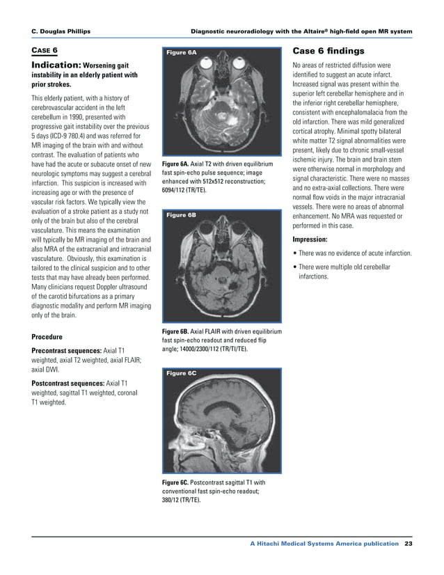 Case Study: Diagnostic Neuroradiology with the Altaire High Field OPEN MRI | PDF