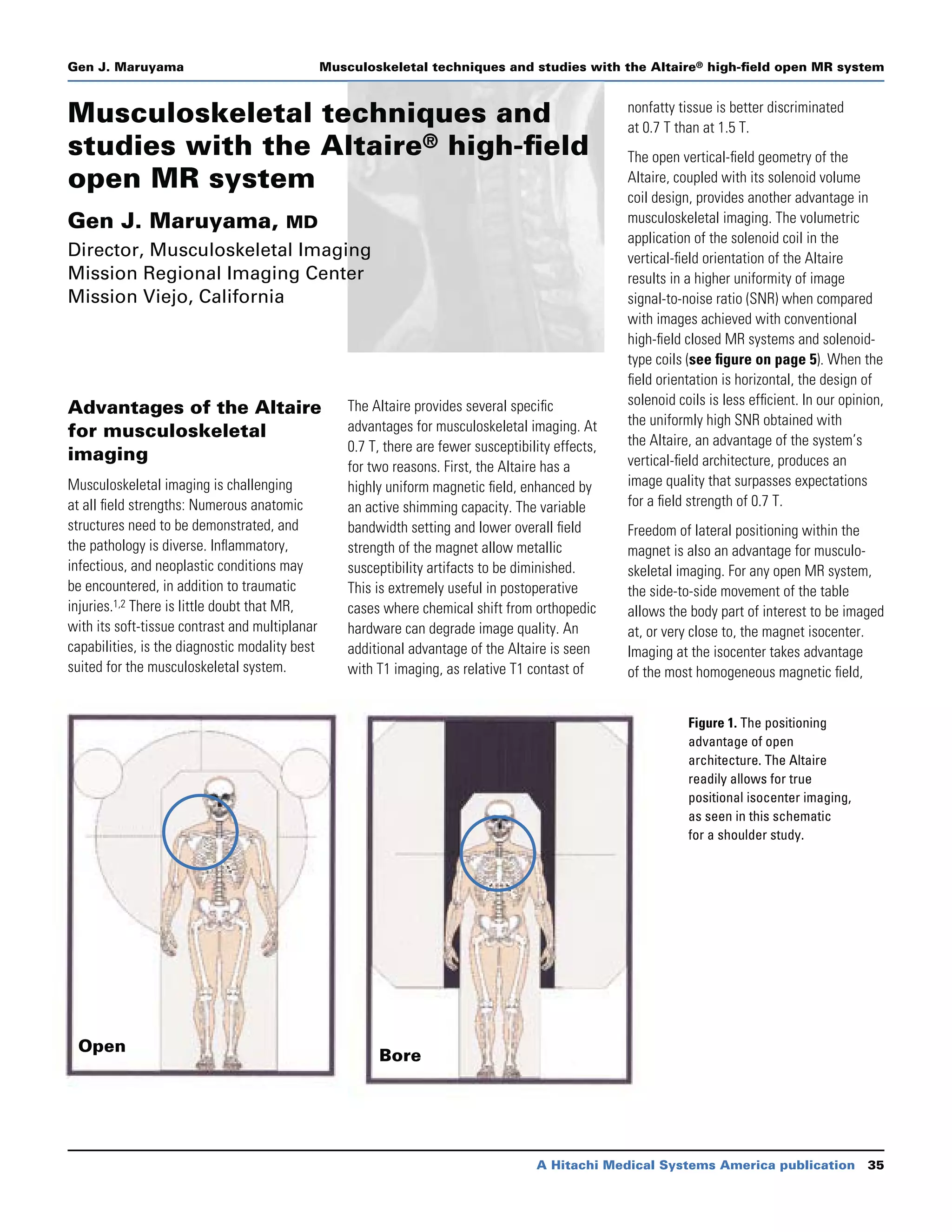 Case study musculoskeletal techniques and studies with the altaire high ...
