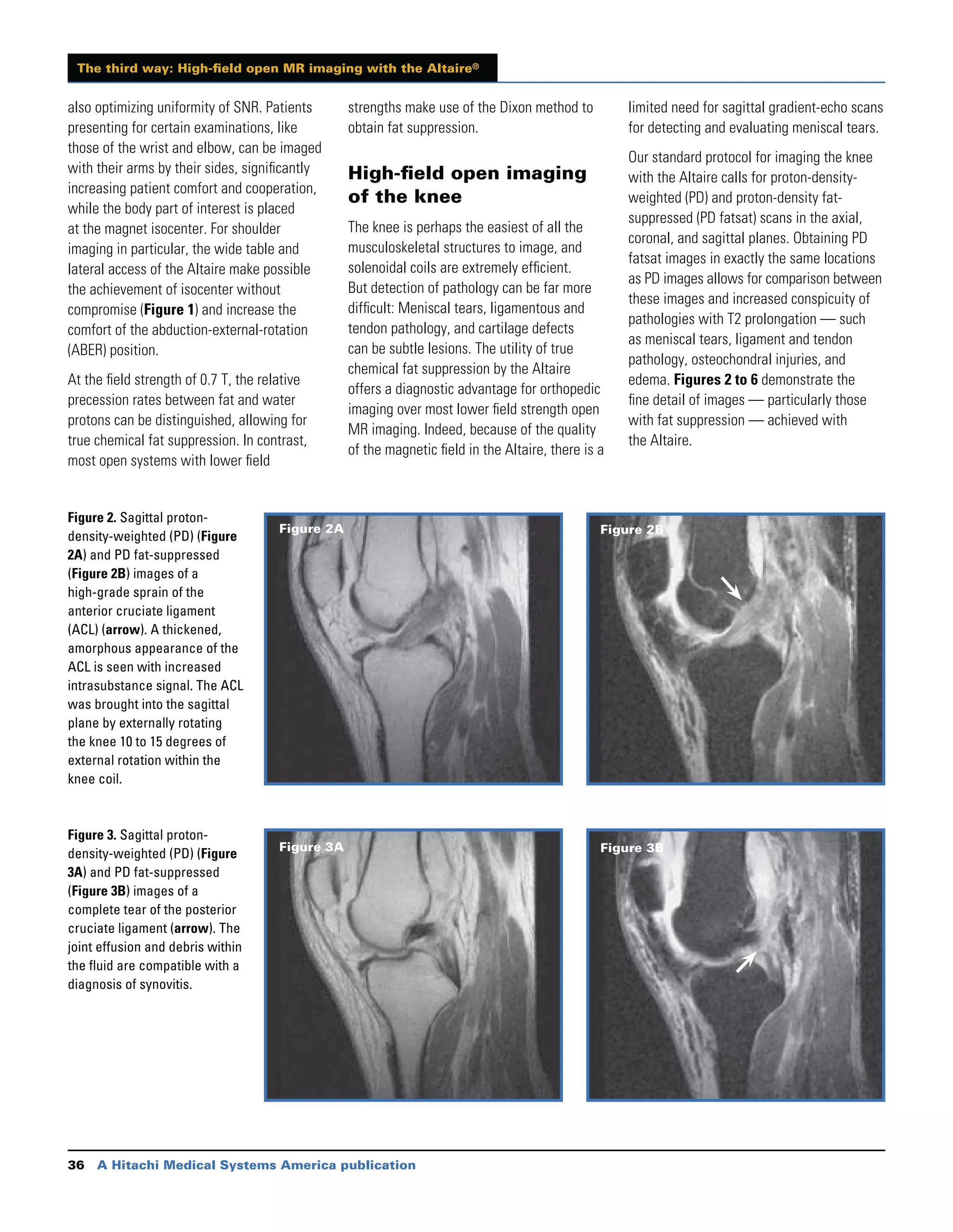 Case study musculoskeletal techniques and studies with the altaire high ...