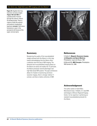 Case study musculoskeletal techniques and studies with the altaire high ...