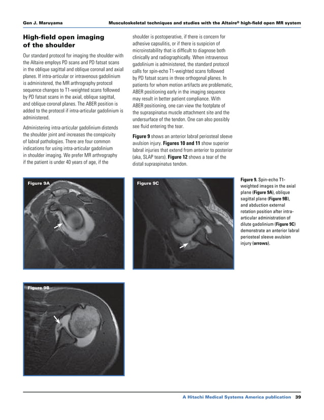 Case Study: Musculoskeletal Techniques & Studies with the Altaire High Field Open MRI | PDF