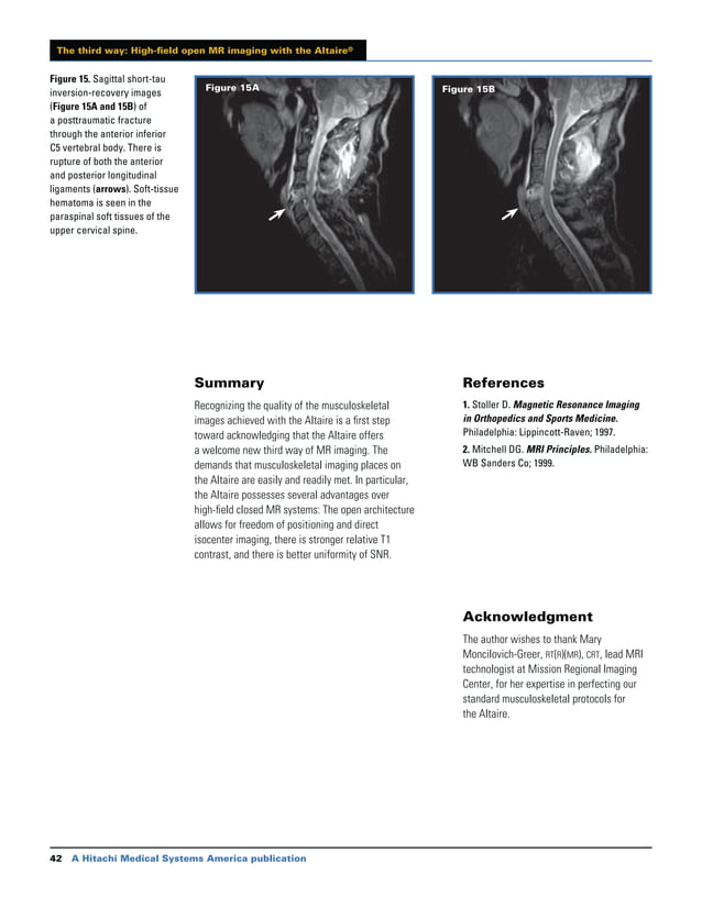 Case Study: Musculoskeletal Techniques & Studies with the Altaire High ...