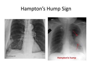 Case Study (2): CT-PA | PPTX